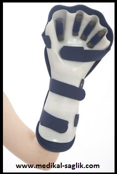 STATİK-EL-BİLEK-SPLİNTİ-PLASTİK-ATEL