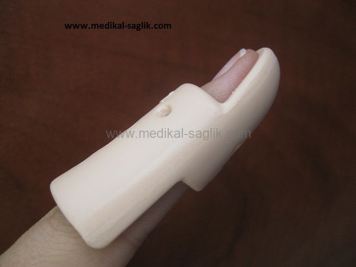 MALLET FİNGER-ÇEKİÇ-PARMAK-ATELİ